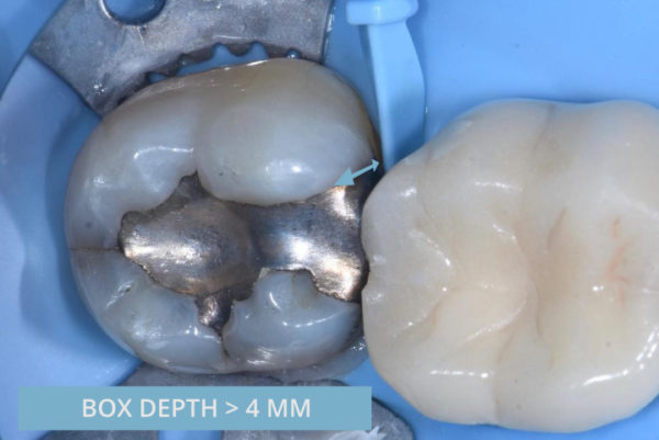 Lesson 2 - Diagnosis and Treatment of Structural Compromises - The ...