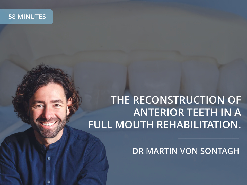 The Reconstruction of Anterior Teeth in a Full Mouth Rehabilitation ...