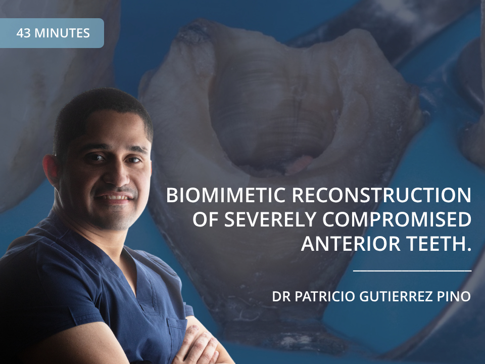 Biomimetic Reconstruction of Severely Compromised Anterior Teeth - Dr ...