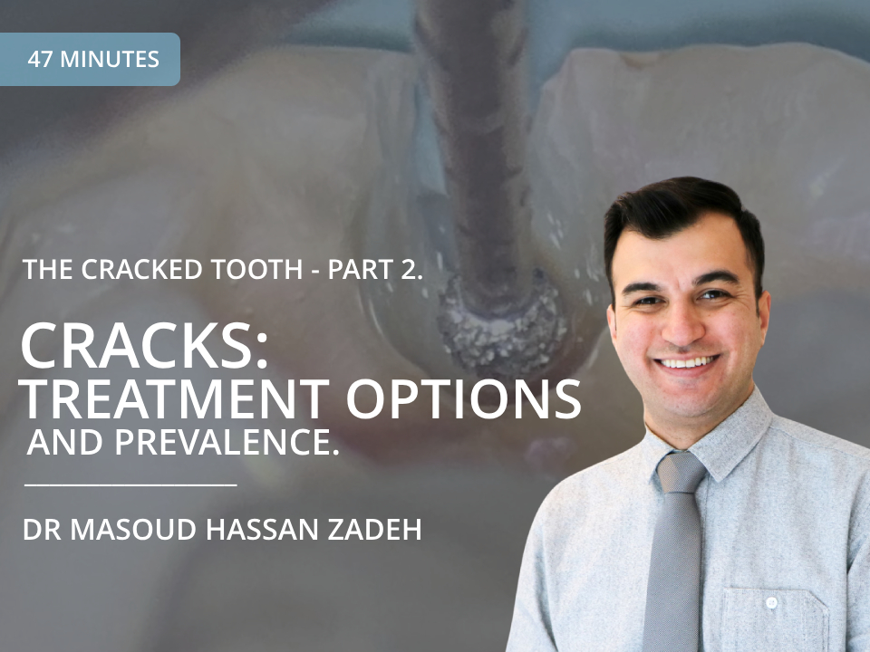 Cracks: Treatment Options and Prevalence - Dr Masoud Hassan Zadeh - The Hybrid Layer